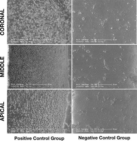 Representative Scanning Electron Microscope Images × 1000 Of Smear