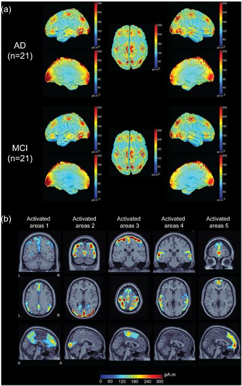 Resting State Networks From Eeg Data A Distributions Of Averaged Download Scientific Diagram