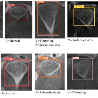 Object Detection Was Achieved Using A Single Regression Model From The Download Scientific