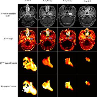 The Change OfKtransvalues A Andkepvalues B And Their Associated 95 Download Scientific