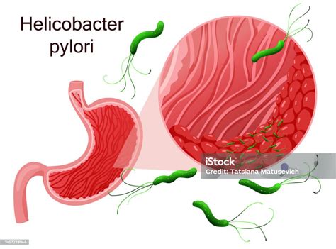 헬리코박터 파일로리 확대 하에서 위 상피 세포에서 벡터 일러스트 레이 션 만화 스타일 헬리코박터 파일로리에 대한 스톡 벡터 아트