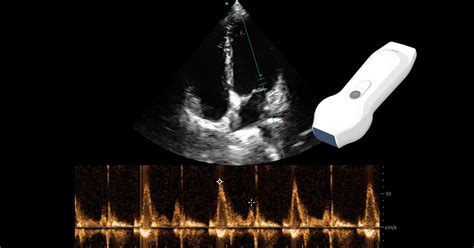 8 Best Portable Echo Ultrasound Machines For Cardiac Care