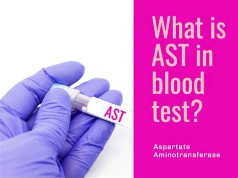 Bilirubin Test About Purpose Uses Interpretation And More A2z Healthy