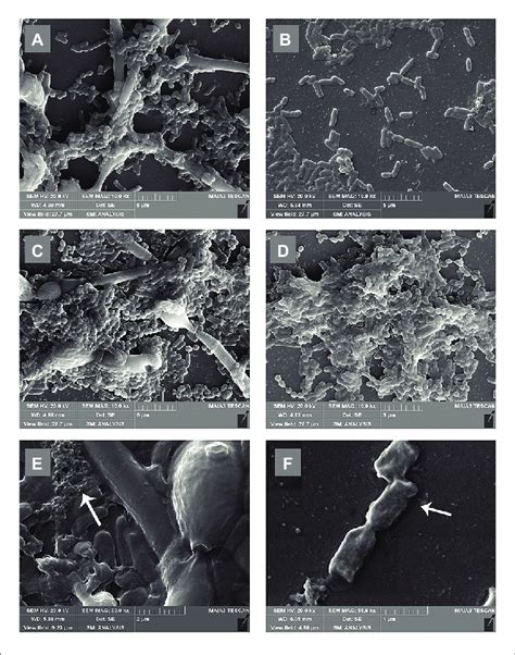 Scanning Electron Microscopy Sem Microtopographies Of Biofilms In