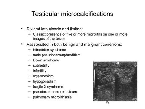 Testicular Ca [edmond]