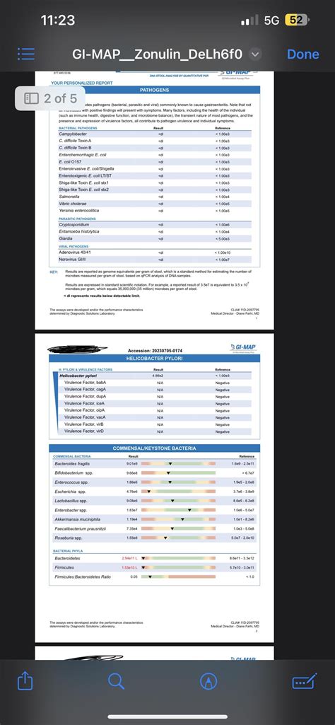 Gi Map Result Interpretation Need Help Not Sure What They All Mean