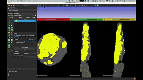 03 Segmenting Insect Body From Ct Scan In 3d Slicer Youtube