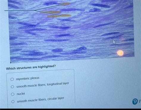 Answered Which Structures Are Highlighted O Myenteric Plexus O Smooth