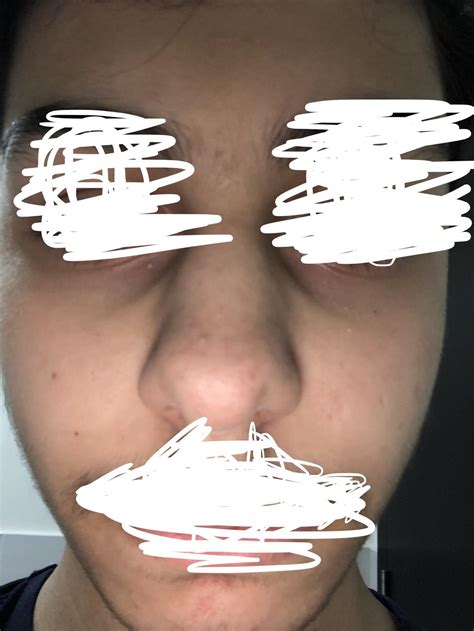 Help Me Clean My Skin R SkincareAddiction