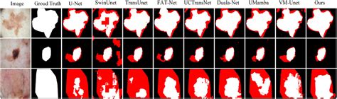 Dma‐net A Dual Branch Encoder And Multi‐scale Cross Attention Fusion