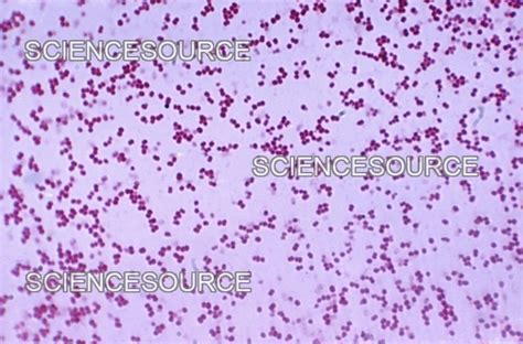 moraxella catarrhalis light micrograp stock image science source