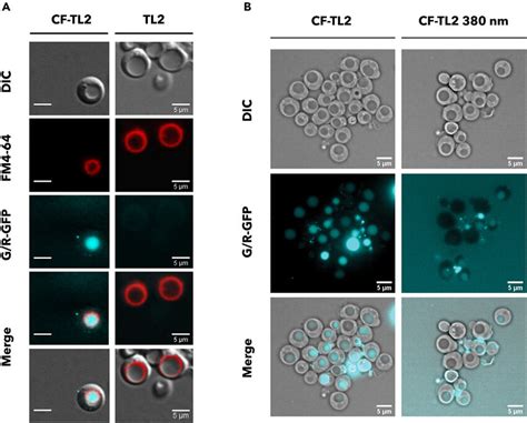 Uptake And Intracellular Distribution Of Tl2 In S Cerevisiae