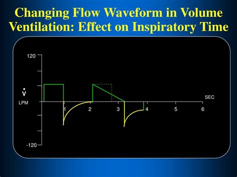 PPT BASICS OF WAVEFORM INTERPRETATION PowerPoint Presentation ID