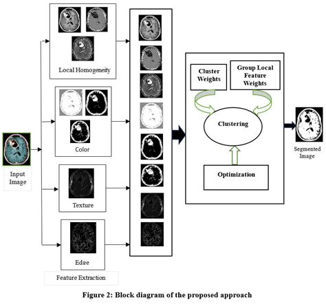 Medical Image Segmentation Using Enhanced Feature Weight Learning Based Fcm Clustering