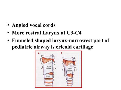 Airway Assessment In Paediatrics Patients Laryngoscopy Intubation Pptx