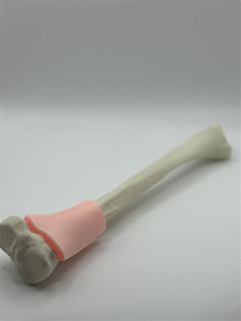 Ez Io Distal Adult Tibia Bone With Skin Patch Pre Hospital Ez Io Distal Adult Tibia Bone With Skin Patch Pre Hospital