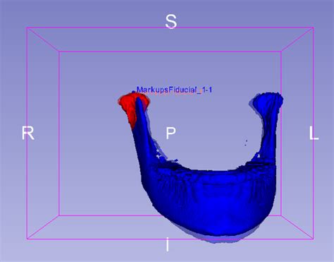 Documentation44modulessurfaceregistration Slicer Wiki
