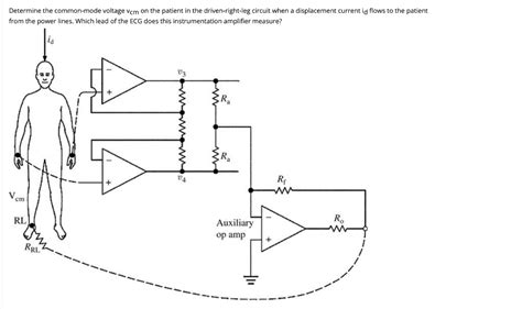 Determine The Common Mode Voltage Vem On The Patient Chegg