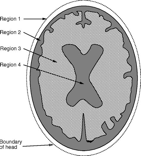 Parenchyma Brain Cerebrospinal Fluid Csf Teachmephysiology