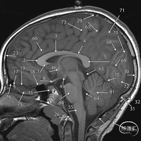 正常人脑中线的大体解剖，你认识多少？ 脑医汇