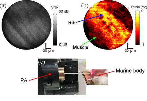 Figure 6 From Ultrahigh Resolution Optical Coherence Elastography Through A Micro Endoscope