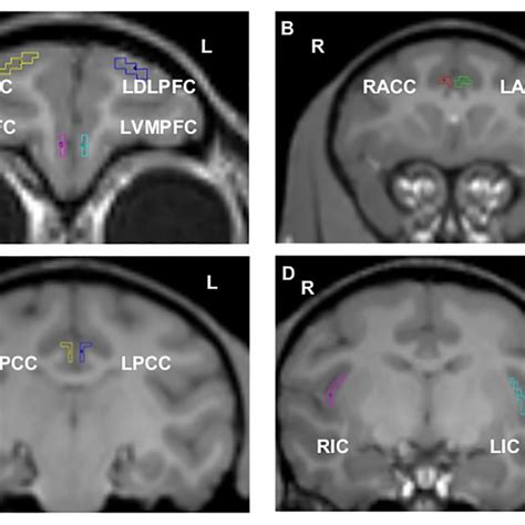 An Example Of How Anterior Cingulate Cortex And Posterior Cingulate Download Scientific Diagram