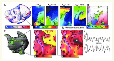 Relationship Between Reentrant Driver Localization And Fibrosis Spatial Download Scientific