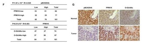 If 9 995 Cell Reports 代谢重编程：破坏谷氨酰胺成瘾，支链氨基酸分解代谢维持肝癌进展 知乎