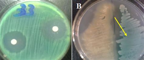 Isolation Technique Everything Microbiology