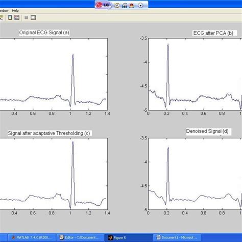 a original ecg signal b ecg after pca c signal after adaptative