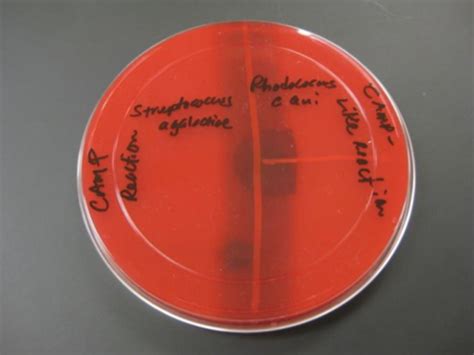 Lab 1 Exam Streptococci Flashcards Quizlet