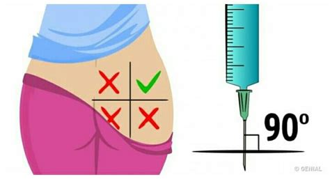 Rules For Intramuscular Injection Vector Image On Vectorstock Artofit
