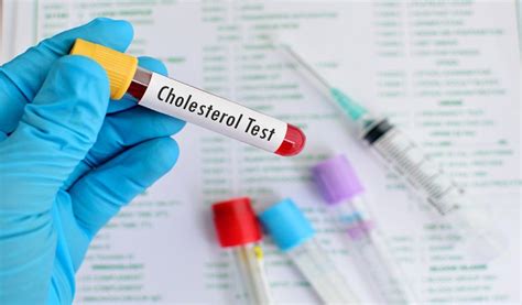 Ldl Vs Hdl Cholesterol Is All Cholesterol Bad Truebasics Blog