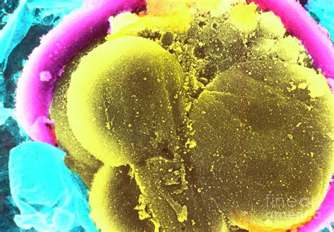 coloured sem of a 4 6 cell segmenting human embryo photograph by professors p m motta and s
