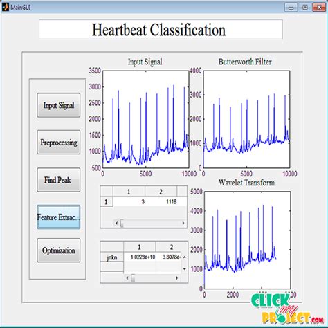 High Performance Personalized Heartbeat Classification Model For Long Term ECG Signal