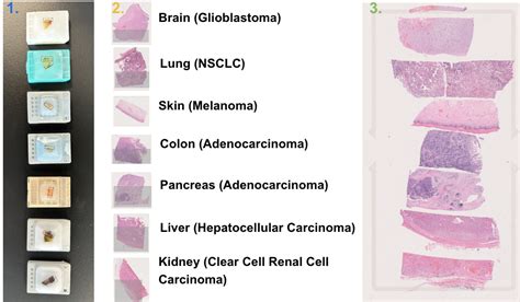 How To Generate Tissue Arrays For Xenium 10x Genomics