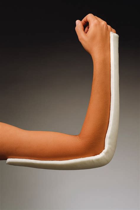 Long Arm Splint — Posterior Elbow Splint Kit For Fractures Orthotape