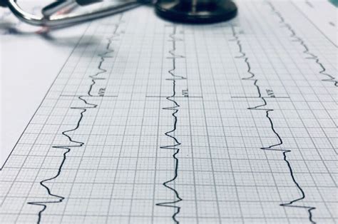 Afib Prevention Meaning Symptoms Diagnosis Treatment And More All