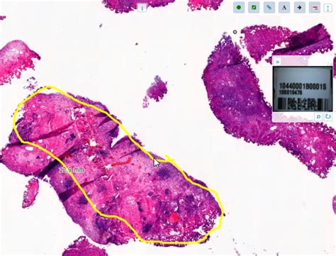 Annotations Et Al Real Data Digital Pathology Blog