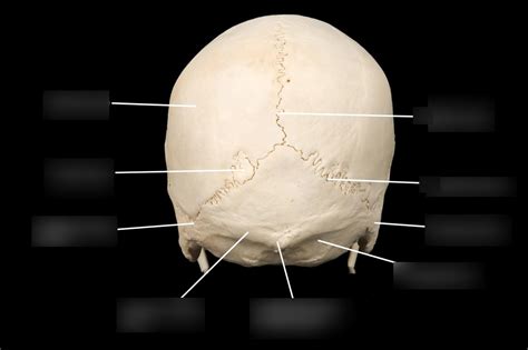 Zygomatic Process Of Temporal Bone Wikipedia