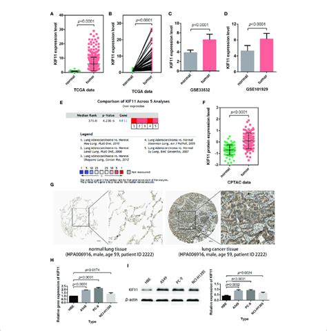Verification Of Kif11 Expression A Unpaired And B Paired Download Scientific Diagram