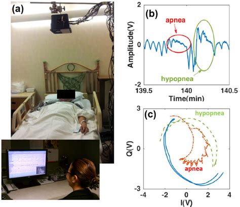 Photograph From Sleep Apnea Detection Clinical Study A And Download Scientific Diagram