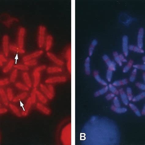 Chromosomal Localization Of Mouse Prolyl Oligopeptidase Gene A