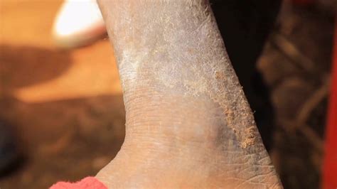 Arba Minch University Added A New Arba Minch University