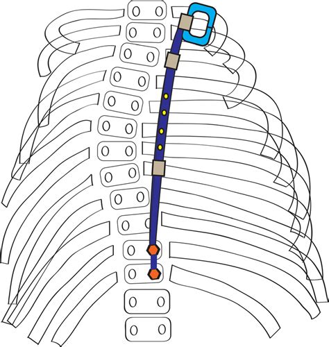 Schematic Representation Of A Hybrid Device A Hybrid Device Attaches Download Scientific