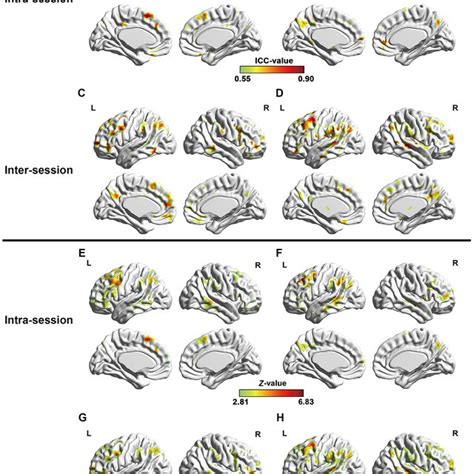 Test Retest Reliability Of Language Network Short Term Reliability Download Scientific Diagram