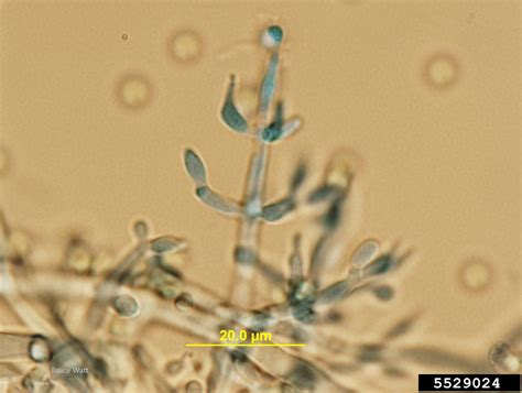 Wood Rot Fungi Genus Trichoderma Pers