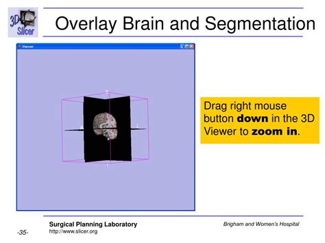 ppt slicer tutorial 6 module vtkfreesurferreaders powerpoint