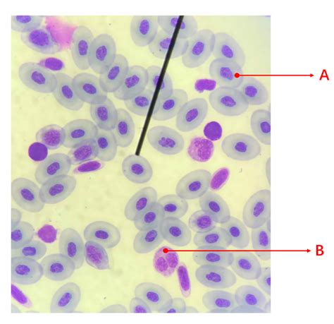 Solved Identify The Type Of Cell Labelled A And B Chegg Com