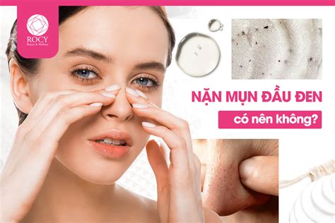 Có Nên Nặn Mụn đầu đen Không Cảnh Báo And Cách Xử Lý An Toàn